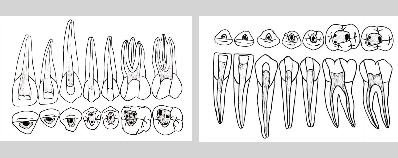 Mastering Tooth Morphology - A Foundation for Clinical Excellence ...
