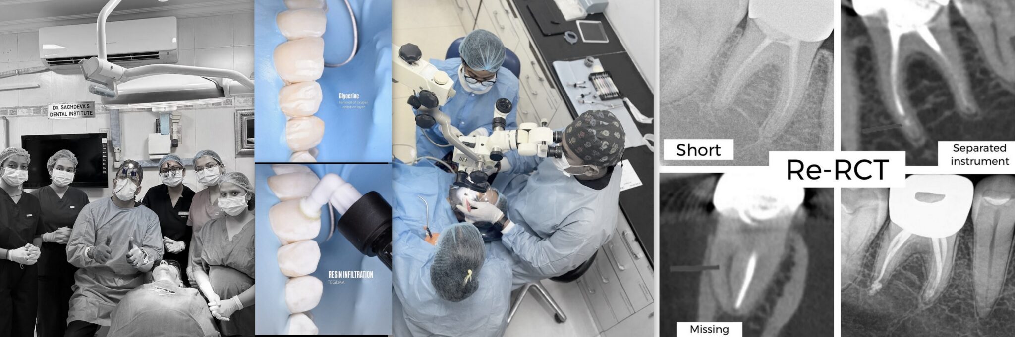Microendodontics 2 Days Course - Dental Courses Delhi